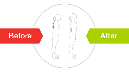 Posture Correction in Warrington - Chiropractic BioPhysics®